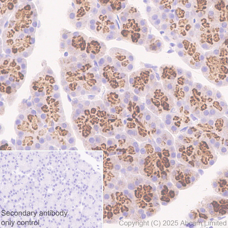 Anti-Trypsin antibody [EPR29805-7] (ab325233) | Abcam