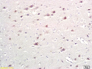 Anti-Tryptophan Hydroxylase/TPH antibody (ab217024) | Abcam