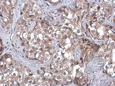 Anti-TSG101 antibody [4A10] - Carrier free (ab83) | Abcam
