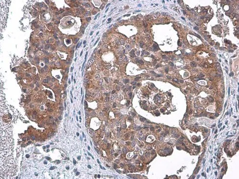 Anti-TSG101 antibody [4A10] - Carrier free (ab83) | Abcam