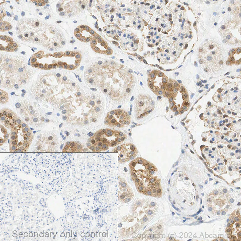 Anti-TSG101 antibody [EPR7130(B)] Rabbit monoclonal (ab125011) | Abcam