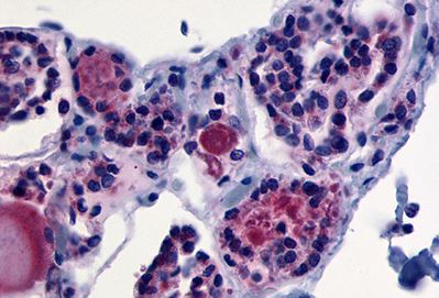 Anti-TSH Receptor/TSH-R antibody - C-terminal (ab188902) | Abcam