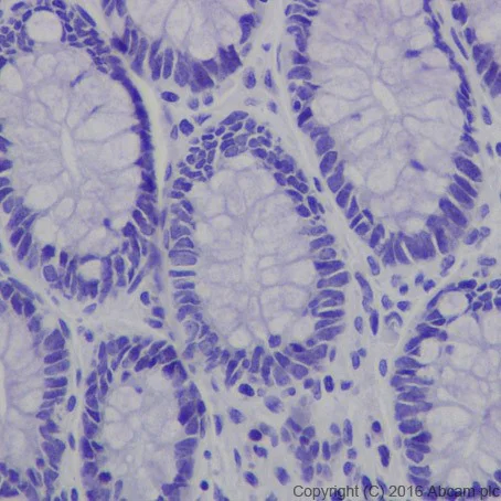 Anti-TSH Receptor/TSH-R antibody [EPR19751] (ab218108) | Abcam