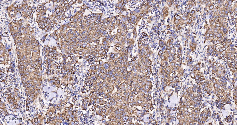 Anti-TSPO antibody [12B8] (ab326712) | Abcam中文官网