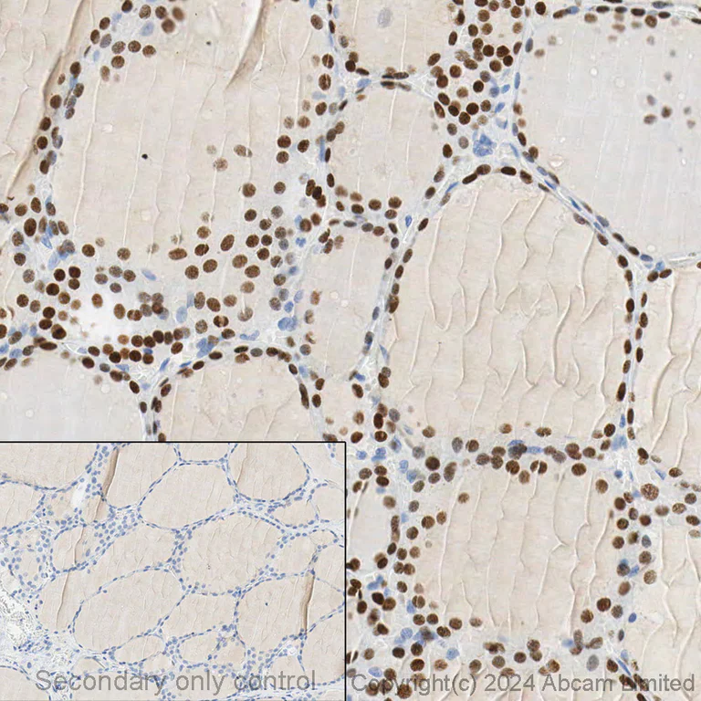 Anti-TTF1/Nkx2-1 antibody [EP1584Y] Rabbit monoclonal (ab76013) | Abcam