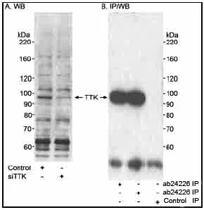 Anti-TTK/Mps1 antibody (ab24226) | Abcam