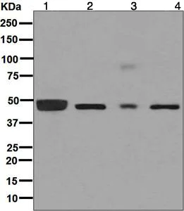 Anti-TUBG1 antibody [EPR8449] - Centrosome Marker (ab129021) | Abcam