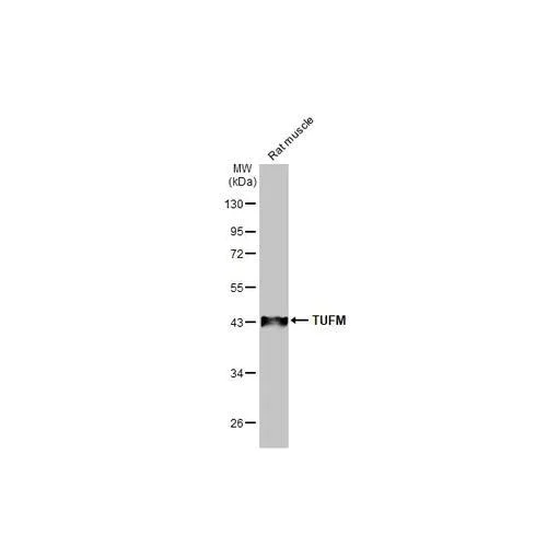 Anti-TUFM antibody [HL2117] (ab317138) | Abcam
