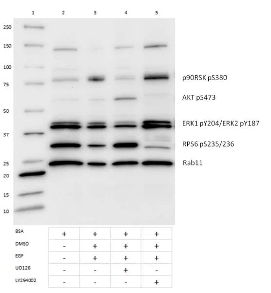U0126, Selective MKK inhibitor (ab120241) | Abcam