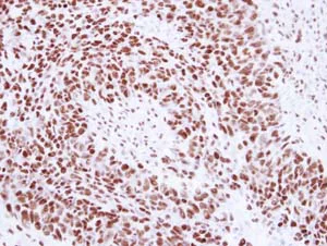 Anti-U1A antibody (ab155054) | Abcam