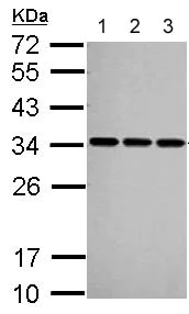 Anti-U1A antibody (ab155054) | Abcam