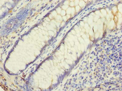 Anti-Ube2G2 antibody (ab235790) | Abcam