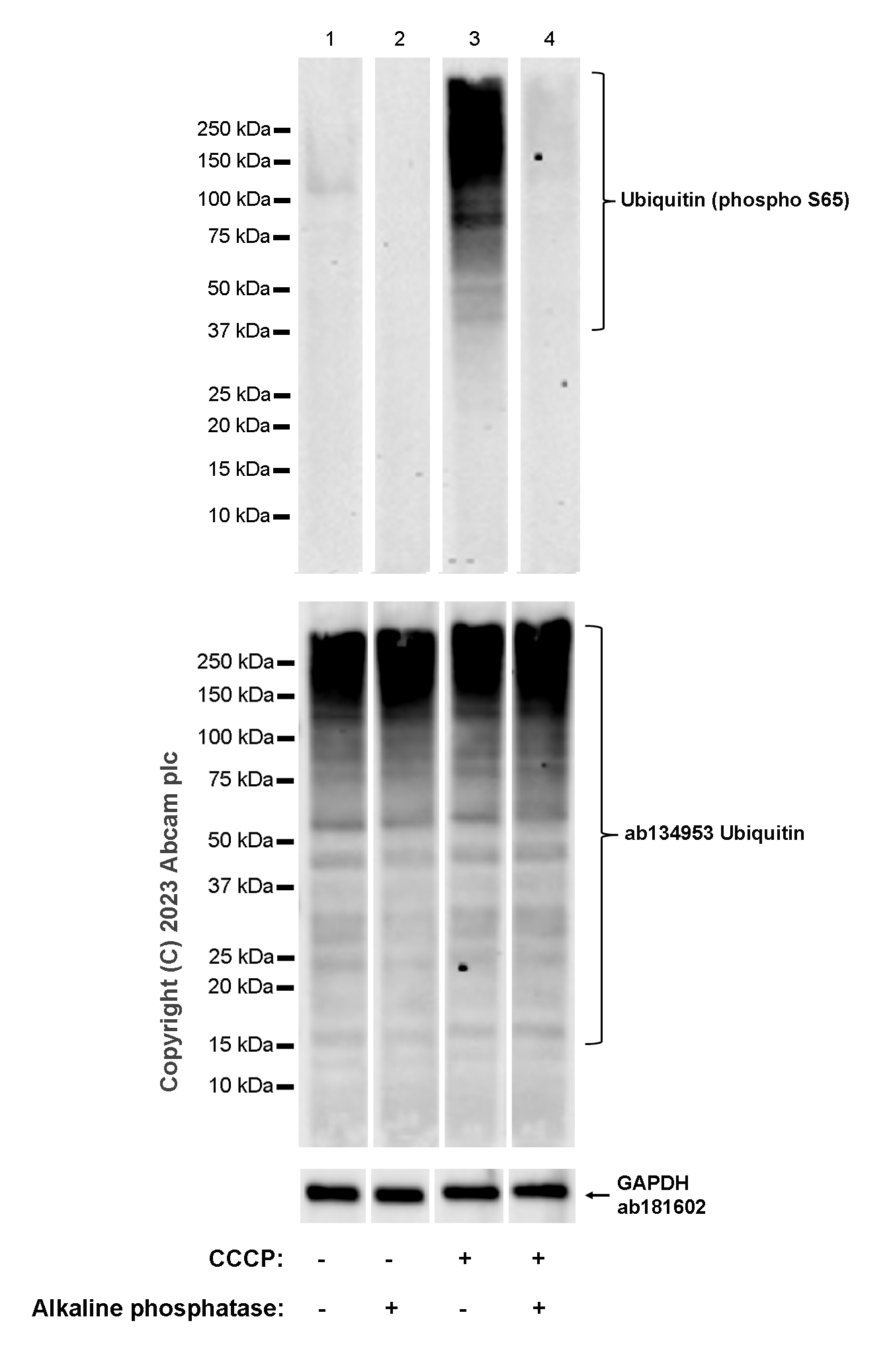 Anti-Ubiquitin (phospho S65) antibody [30H3/30K1] (ab309155) | Abcam