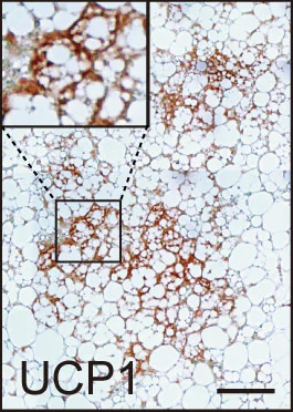 UCP1抗体 (ab10983)| Abcam中文官网