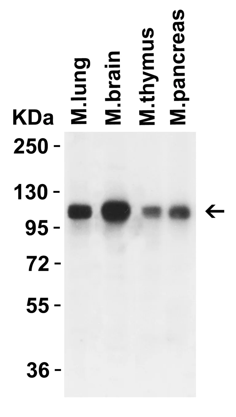 ULK1抗体 (ab167139)| Abcam中文官网