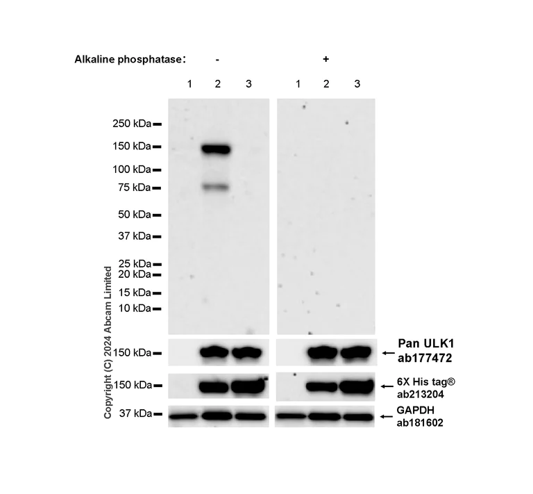 ULK1抗体[EPR6153(2)] (ab177472)| Abcam中文官网