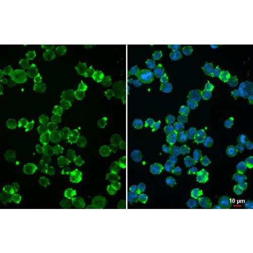 Anti-uPAR antibody [HL2169] (ab317150) | Abcam