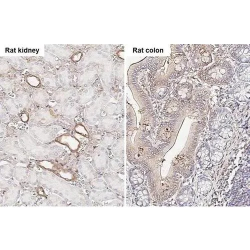 Anti-uPAR antibody [HL2169] (ab317150) | Abcam