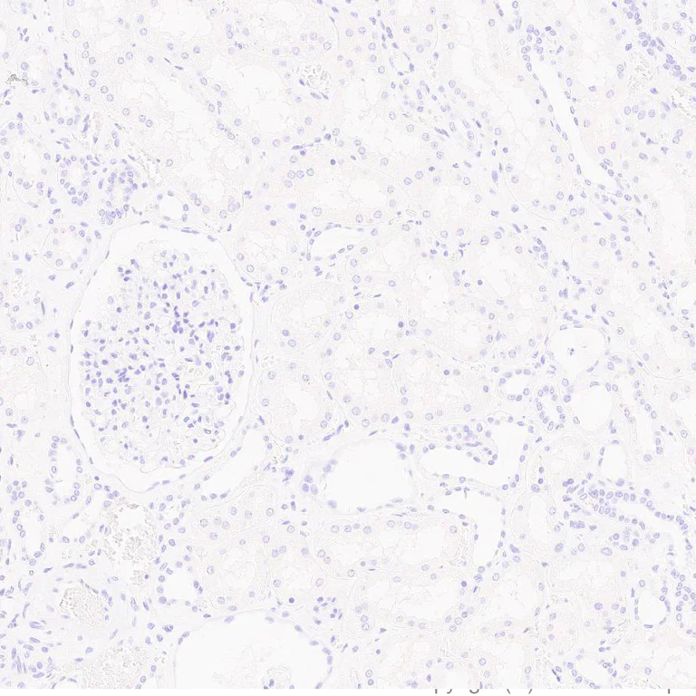 Uteroglobin抗体[EPR27144-86] (ab307666)| Abcam中文官网