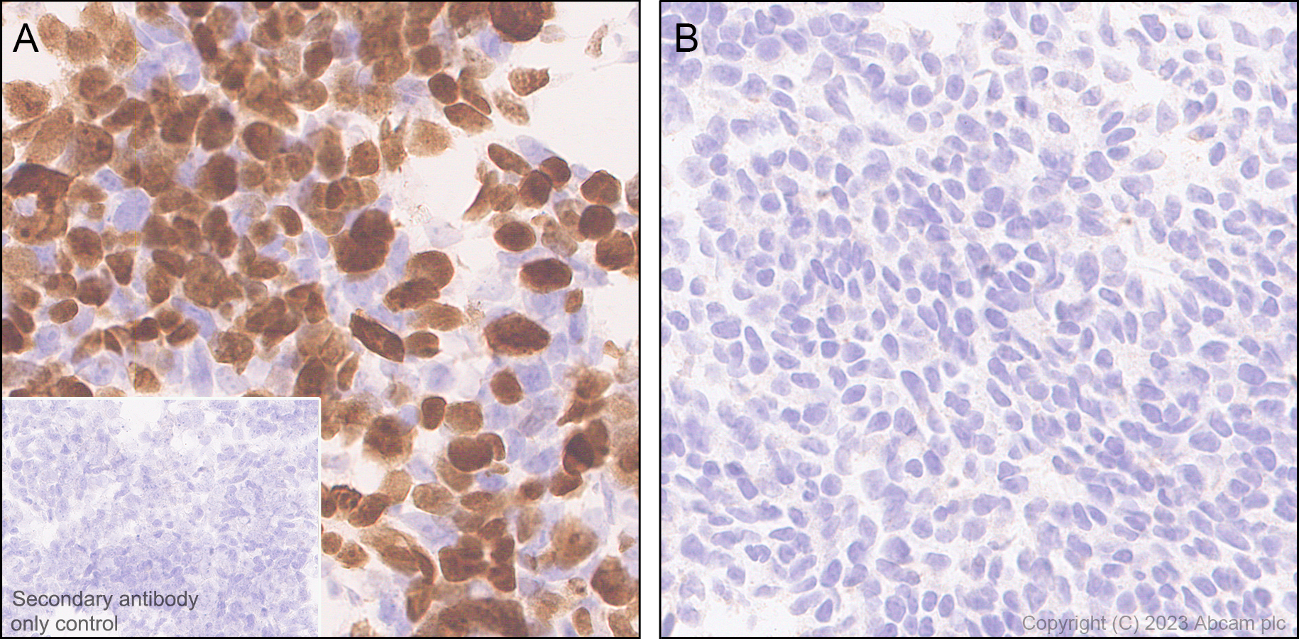 Anti-V5 tag antibody [EPR27187-61] (ab309485) | Abcam