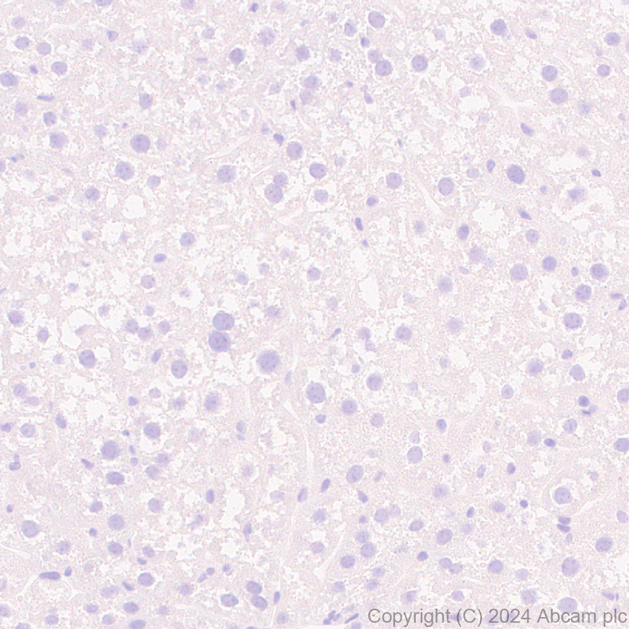 Anti-VAChT antibody [EPR29154-71] (ab317452) | Abcam