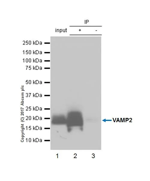 VAMP2抗体[EPR20818] (ab215721)| Abcam中文官网