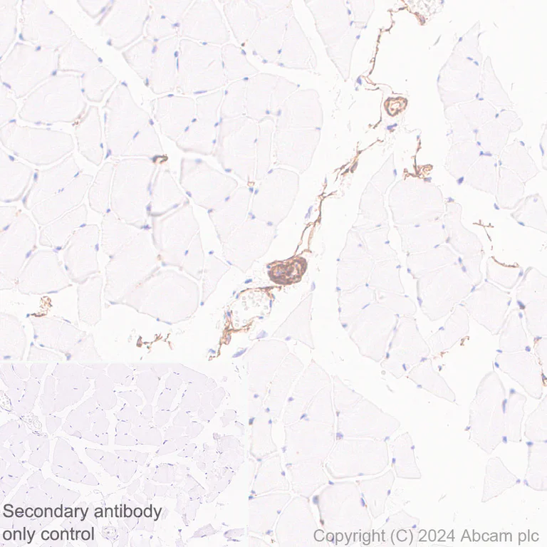 Anti-VAP1 antibody [EPR28748-59] (ab317620) | Abcam