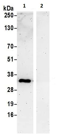 Anti-VAPA antibody (ab225890) | Abcam