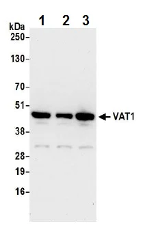 Anti-VAT1 antibody (ab242045) | Abcam
