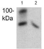 Anti-VAV2 (phospho Y172) antibody (ab86695) | Abcam
