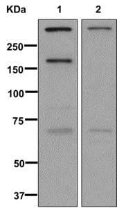 Anti-Versican antibody [EPR12277] Rabbit monoclonal (ab177480) | Abcam