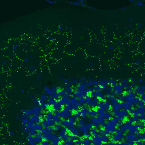 Anti-VGLUT2 antibody [CL2921] (ab211869) | Abcam