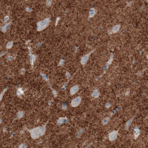 Anti-VGLUT2 antibody [CL2921] (ab211869) | Abcam