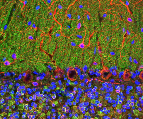 Anti-VILIP1 antibody [3A9] (ab315190) | Abcam