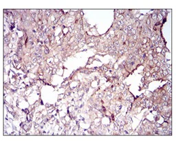Anti-Villin antibody [5E3B2] (ab202021) | Abcam