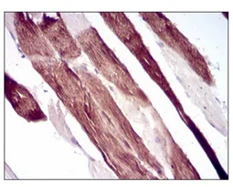 Anti-Villin antibody [5E3B2] (ab202021) | Abcam