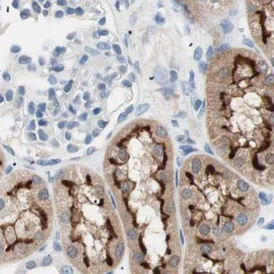 Anti-Villin antibody (ab244292) | Abcam