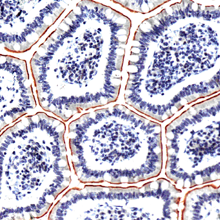 Anti-Villin antibody (ab52102) | Abcam