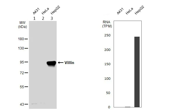 Anti-Villin antibody (ab97512) | Abcam