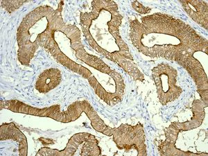 Anti-Villin antibody [EPR3491(3)] - BSA and Azide free (ab248530) | Abcam