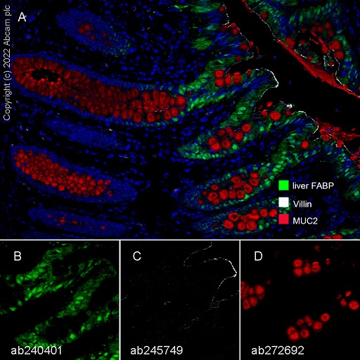 Anti-Villin antibody [SP145] (ab130751) | Abcam