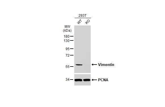Anti-vimentin antibody - rabbit polyclonal (ab137321) | Abcam