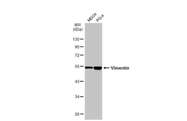 Anti-vimentin antibody - rabbit polyclonal (ab137321) | Abcam