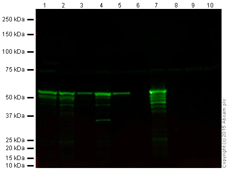 Anti-Vimentin antibody - Cytoskeleton Marker (ab45939) | Abcam