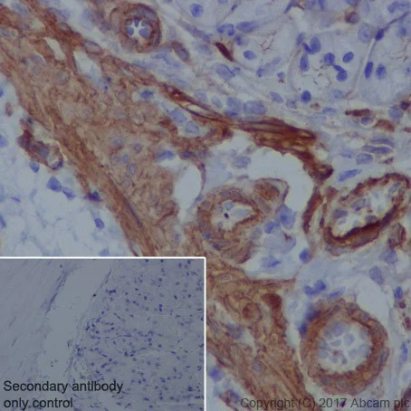 Anti-Vinculin antibody [EPR20407] - Loading Control (ab219649) | Abcam