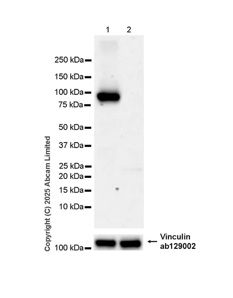 Anti-Vinculin antibody [EPR8185] KO tested (ab129002) | Abcam