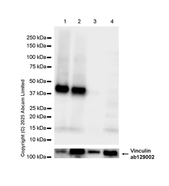 Anti-Vinculin antibody [EPR8185] KO tested (ab129002) | Abcam