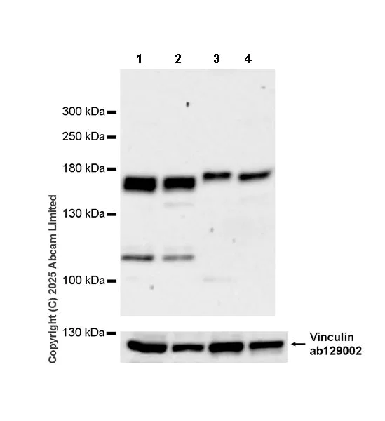 Anti-Vinculin antibody [EPR8185] KO tested (ab129002) | Abcam