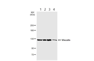 Anti-Vinculin antibody. Rabbit polyclonal (ab155120) | Abcam