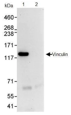 Vinculin antibody, rabbit polyclonal (ab91459) | Abcam